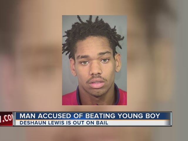 Suspect identified in severe beating of child