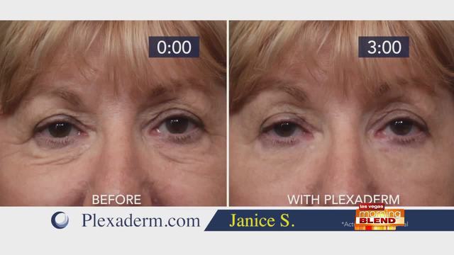 Plexaderm | 10/18/17 - KTNV.com Las Vegas